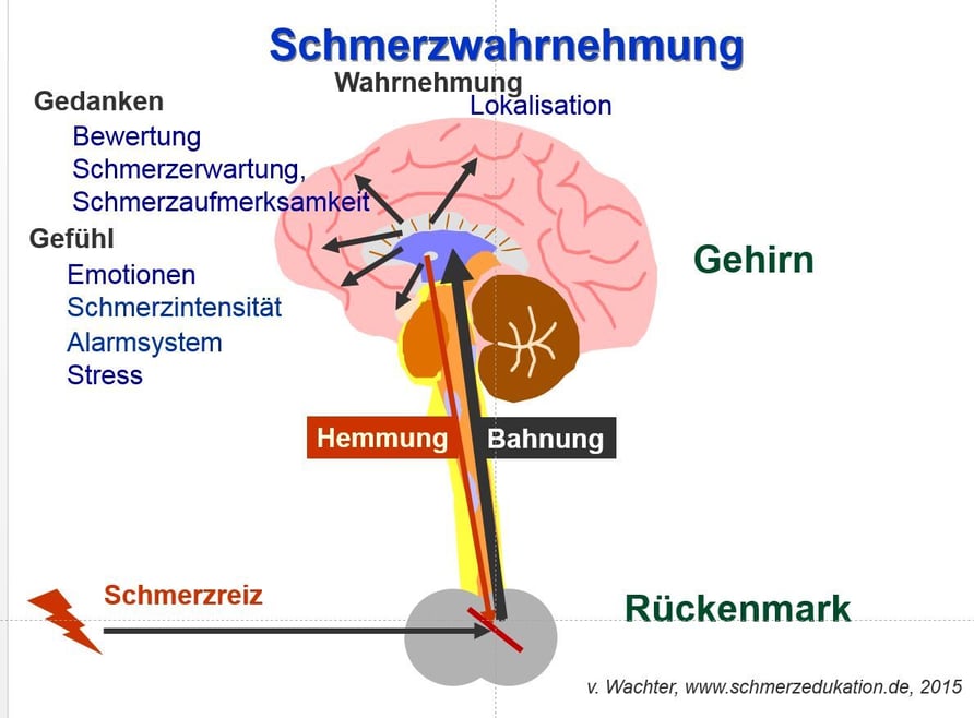 Blog: Chronische Schmerzen | AMBOSS